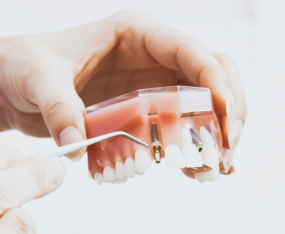 Especialidad en Prostodoncia | UAG